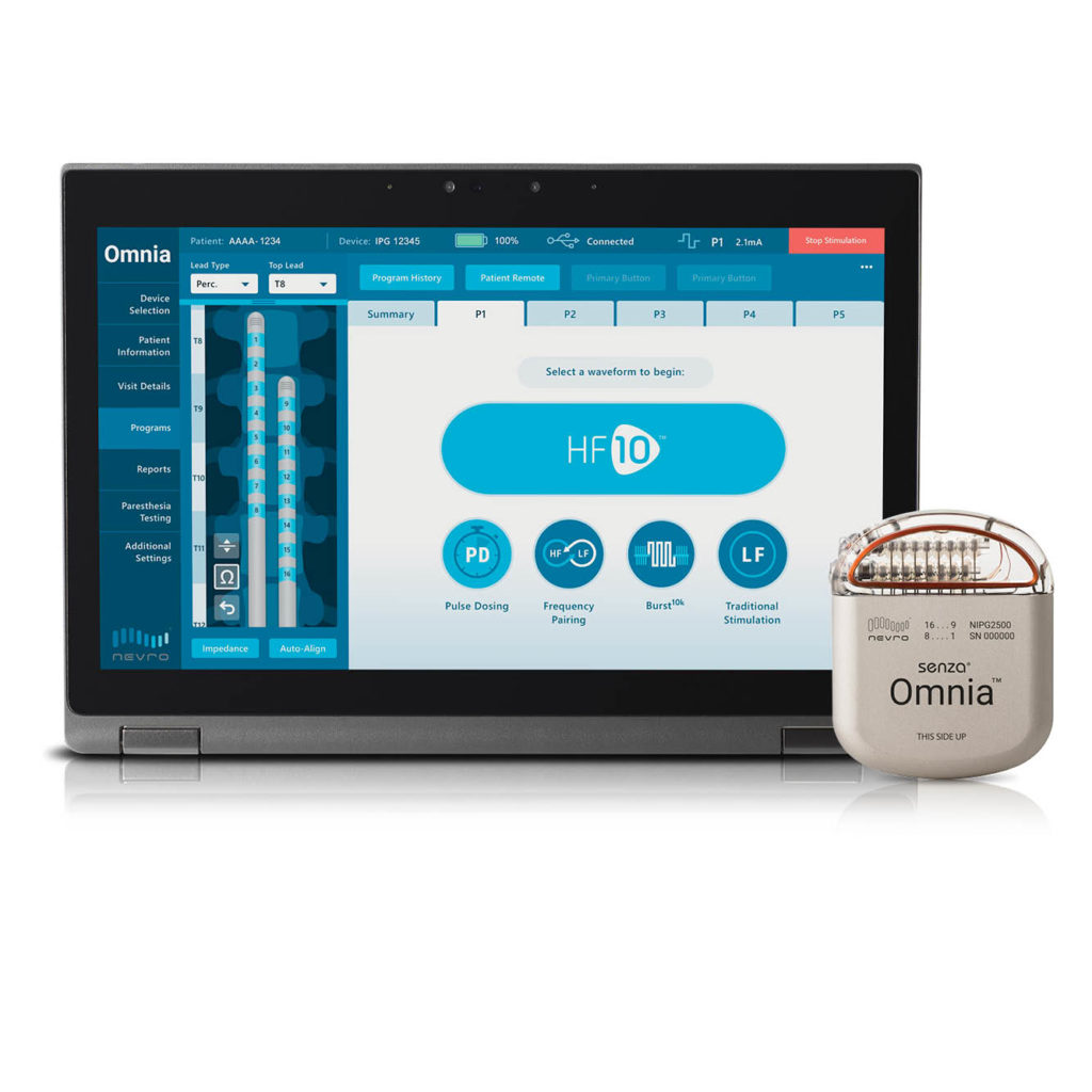 Spinal Cord Stimulation with HF10 - Neurovations Research